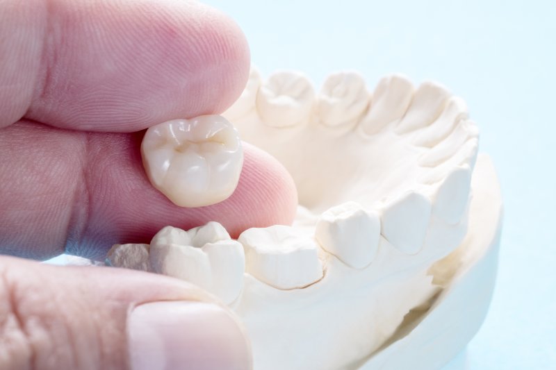 What Are Signs Dental Crown Replacement Is Needed | Hooks Family Dentistry